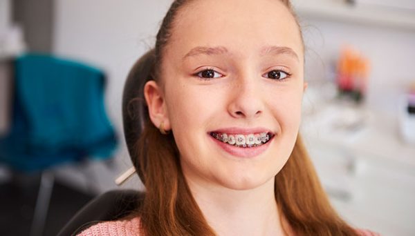 Traditional Braces in Etobicoke | Roha Dental