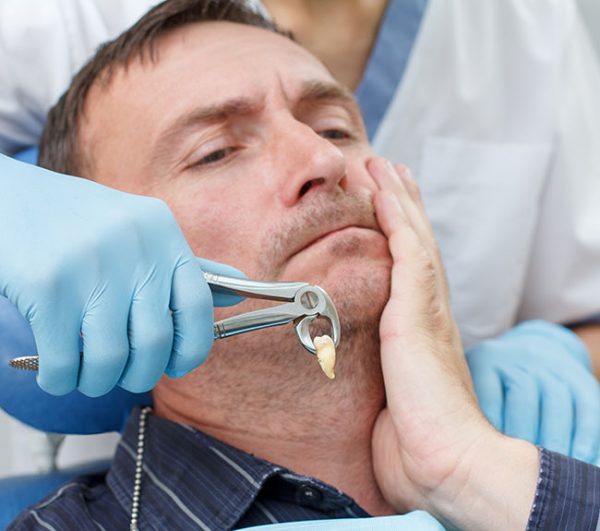 Wisdom Teeth Removal in Etobicoke | Roha Dental